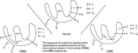Ventricular Depolarization