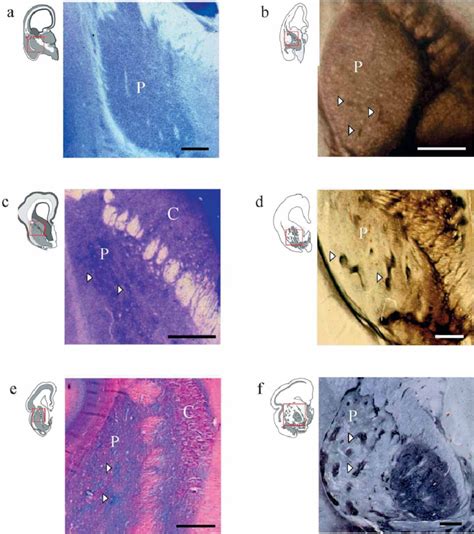 Transversal Sections Through The Human Striatum Showing Cellular