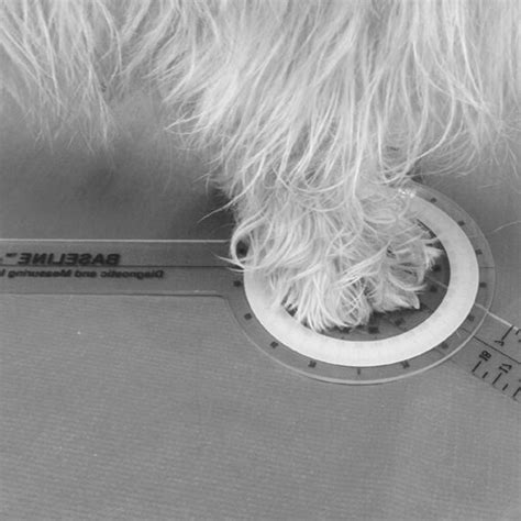 A 30 Cm Plastic Goniometer With Its Axis Placed Under The Metacarpal