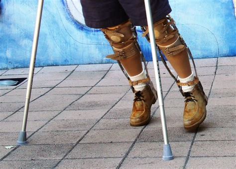 Crutches And Swinging Leg Braces Seeing A Swing Thru Gait Flickr
