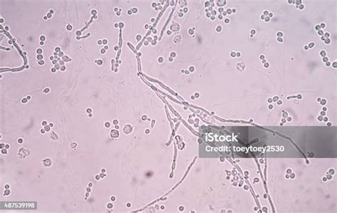 เซลล์ยีสต์แตกแขนงที่มี Pseudohyphae ในตัวอย่างปัสสาวะ ภาพสต็อก ดาวน์