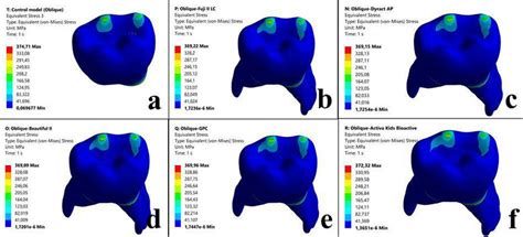 Distribution Of Von Mises Stress For Models With Oblique Loading A