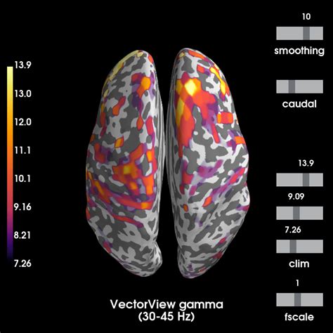 Compute Source Power Spectral Density Psd Of Vectorview And Opm Data — Mne 0212 Documentation
