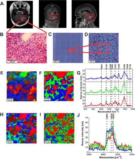 The Mri Image A Hande Stained Histological Image B Stitching