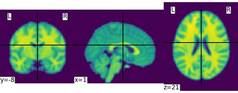 Nilearn Statistical Analysis For Neuroimaging In Python — Machine Learning For Neuroimaging