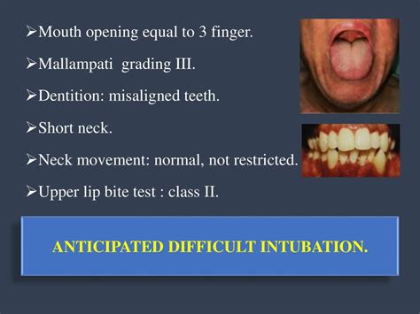 Busted Lip From Intubation At Layla Helms Blog