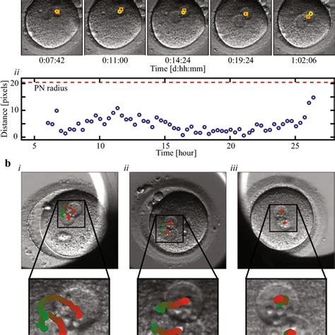 Trajectories Of Pn Dynamics Depicted Using Optical Flow A Validation Download Scientific