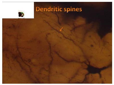 Neuron Pyramidal Cell Ppt Download