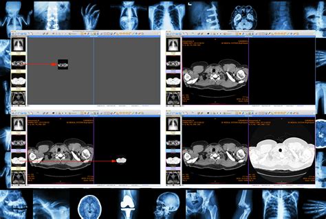 sante dicom viewer mac 软件 官方授权正版软件平台