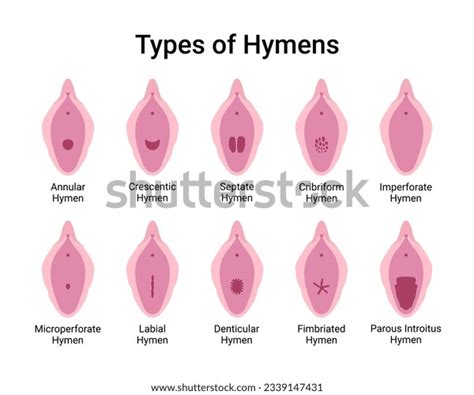 Hymen Shapes Photos And Images Shutterstock