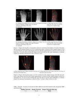 Fractionally Strided Convolution Definition DeepAI