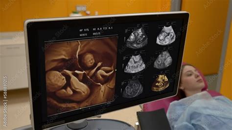 How To Scan Pregnancy With Phone At Edith Drum Blog