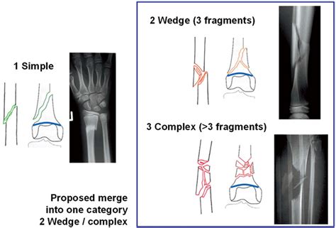 Definition Of Fracture Severity Code And Proposed Simplification The Download Scientific