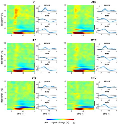 Time Frequency Representations Of Local Oscillatory Brain Activity In
