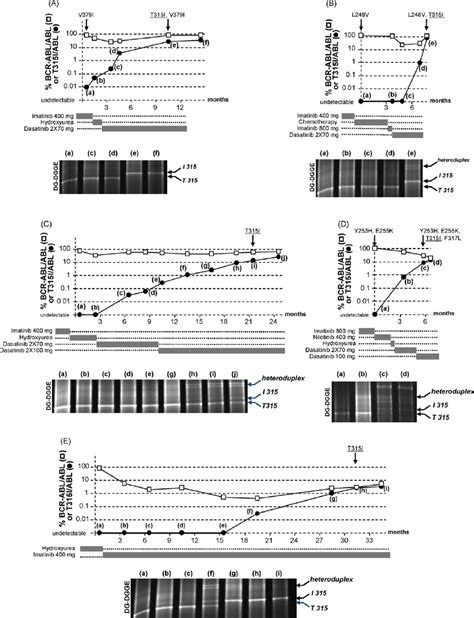 Kinetics Of Bcr Ablabl And Bcr Abl 315i Abl Ratio In Five Cml Download Scientific Diagram