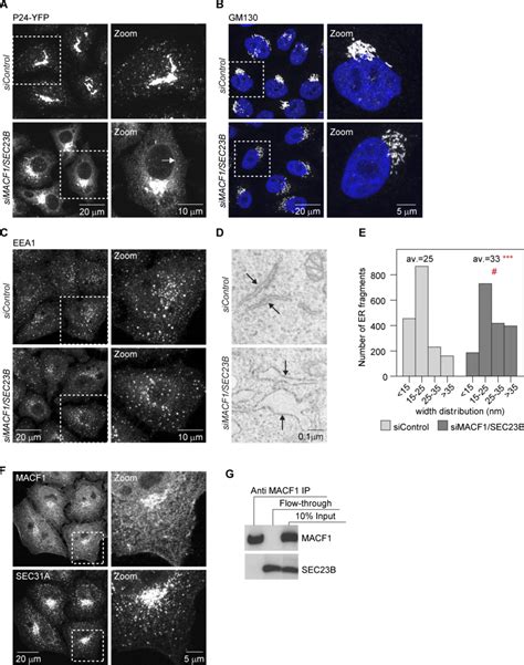 Macf1 Functionally Interacts With Sec23b At The Er Exit Level A Download Scientific Diagram