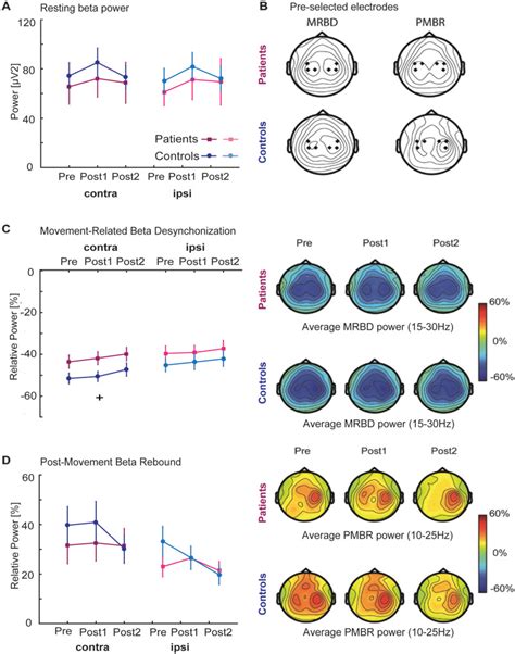 sensorimotor cortex beta oscillations reflect motor skill learning
