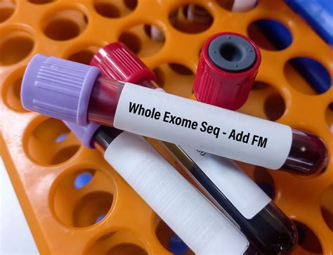 A Smartphone Based Disposable Hemoglobin Sensor Based On Colorimetric