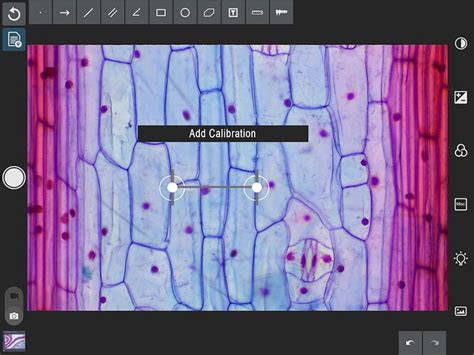 How Can I Identify The Size Of The Annotation Area In Mm² Qupath