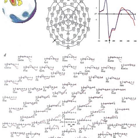 A Scalp Topography Front Of Head Is At Top T Test Plot Of The Download Scientific Diagram