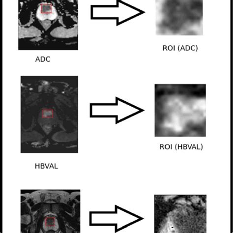 Interpretation Of Quadratic Weighted Kappa Download Scientific Diagram
