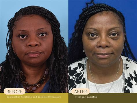 Releve Plastic Surgery Cincinnati Plastic Surgeons