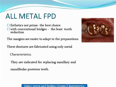 General Considerations Components And Classification Of Fpd Christeena