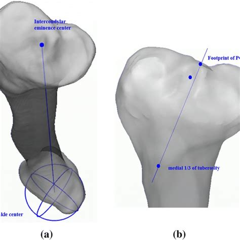 Schematic Representation Of Tibial Coordinate System Organization A Download Scientific