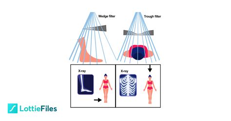 Compensating Filter Ct New By Joana Barreira Lottiefiles