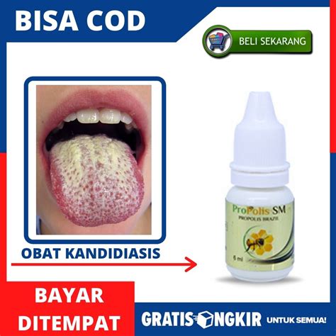 Obat Penyakit Kandidiasis Aman Bpom Halal Infeksi Jamur Di Lidah