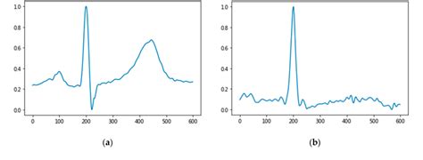 Figure 4 From Myocardial Infarction Classification Based On Convolutional Neural Network And