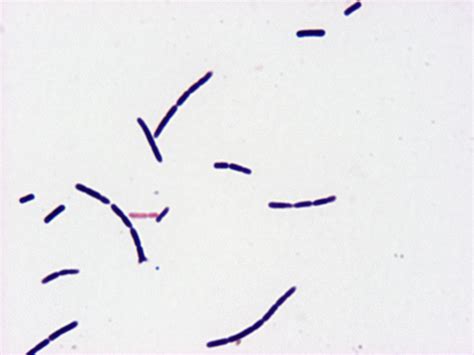 Lactobacillus Gram Stain