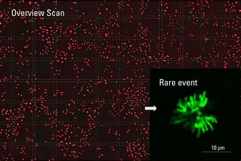 ai microscopy enables the efficient detection of rare events learn