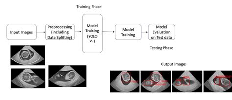 Enhancing Fetal Health Monitoring Leveraging Yolov7 For Ultrasound