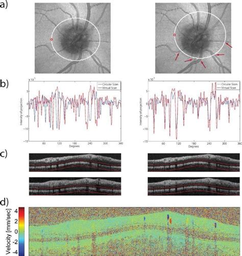Registration Of The 2d Circular Scan To The 3d Volume A Initial