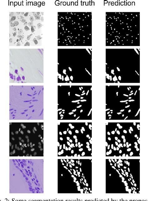Figure 2 From A Cnn Transformer Based Approach For Medical Image Segmentation Semantic Scholar