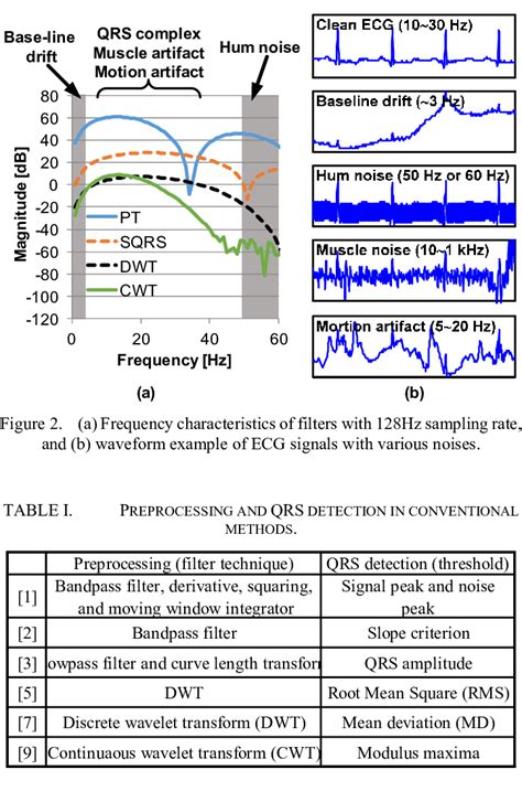Noise Problem With Threshold Based R Peak Detection Download Scientific Diagram