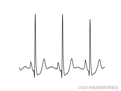 使用python绘制无边框ecg信号 可用于论文插图 小白版ecg Python Csdn博客