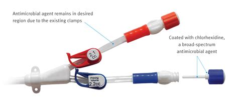 Clearguardtm Hd Caps Antimicrobial Barrier Caps Icu Medical