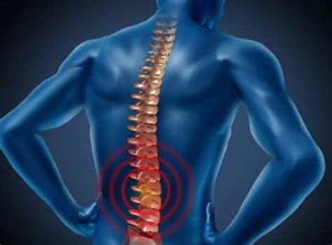 Microscopic Discectomy Recovery And Treatment In Delhi