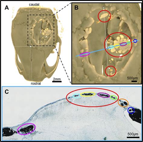 The Induction Of Bone Formation By 3d Printed Plga Microsphere Scaffolds In A Calvarial
