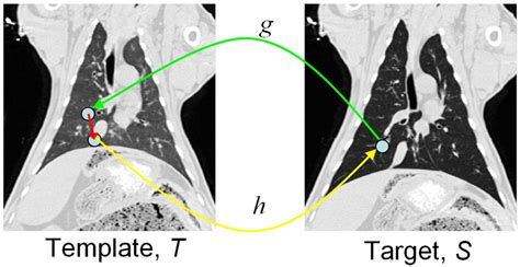 Inverse Consistent Linear Elastic Registration Jointly Estimating Handg Download Scientific