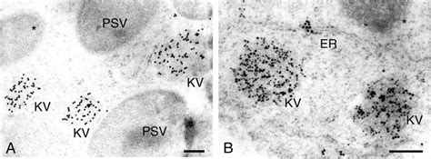 Functional Analysis Of The Kdel Vesicle Lifeasible
