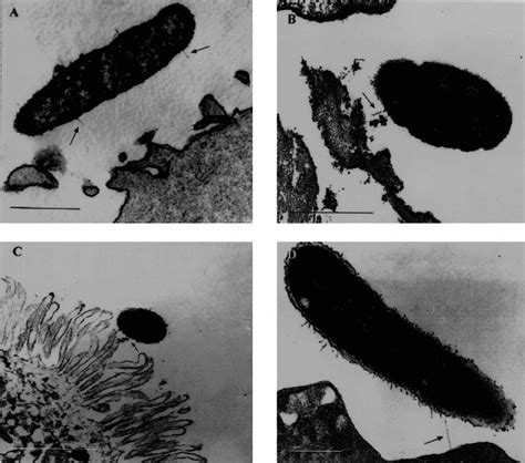 Transmission Electron Micrographs Thin Sections Ruthenium Red Stain