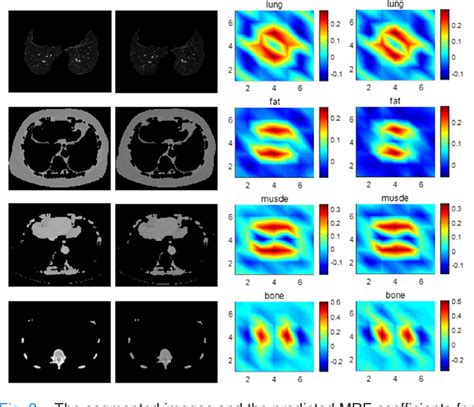 Figure 1 From Spectral Ct Reconstruction Via Low Rank Representation And Region Specific Texture