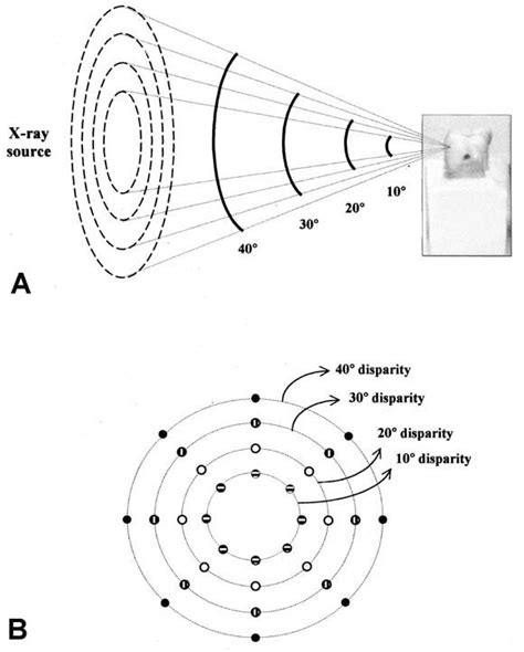 Effect Of Angular Disparity Of Basis Images And Projection Geometry On Caries Detection Using