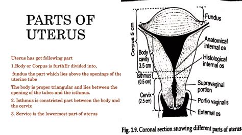 Retroverted Uterus Pptx
