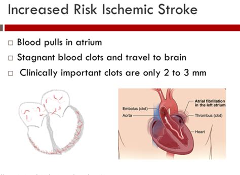 Atrial Fibrillation Flutter Flashcards Quizlet