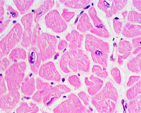 Cardiac Muscle Cross Section Histology Skeletalmuscular System