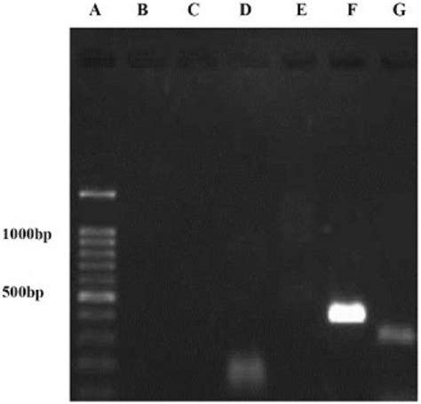 Amplification Of Colicin Ans4 E1 Iab Genes A Dna Ladder B Download Scientific Diagram